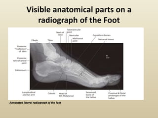 Radiographic Anatomy of the Lower Limbs.pptx
