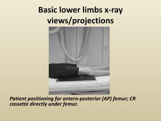 Radiographic Anatomy of the Lower Limbs.pptx