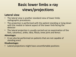 Radiographic Anatomy of the Lower Limbs.pptx
