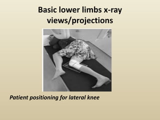 Radiographic Anatomy of the Lower Limbs.pptx