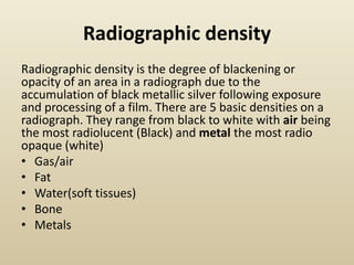 Radiographic Anatomy of the Lower Limbs.pptx