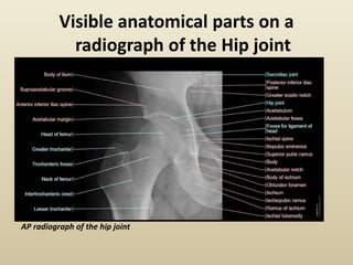 Radiographic Anatomy of the Lower Limbs.pptx