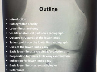 Radiographic Anatomy of the Lower Limbs.pptx
