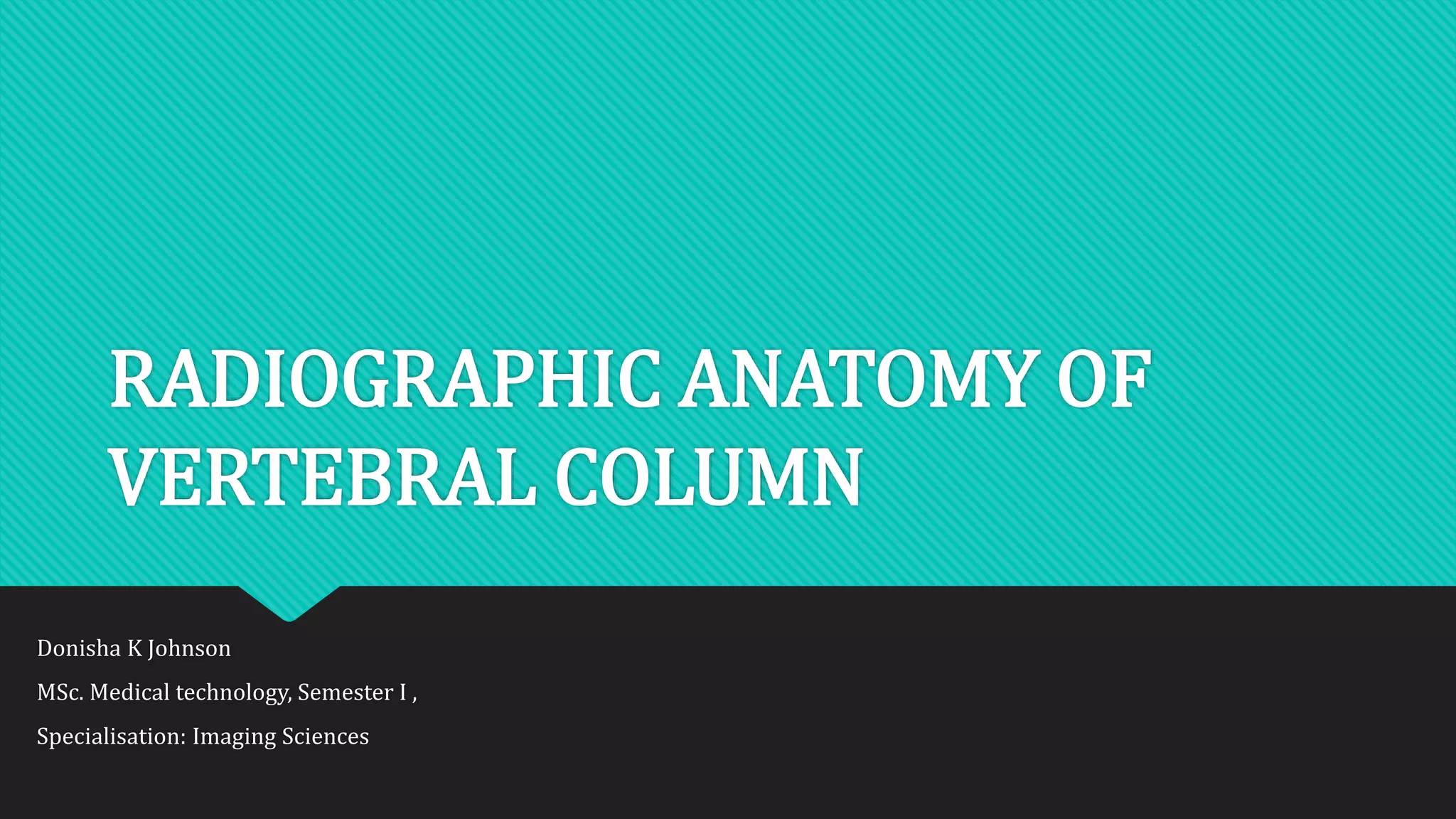 Radiographic anatomy of vertebral column | PPTX