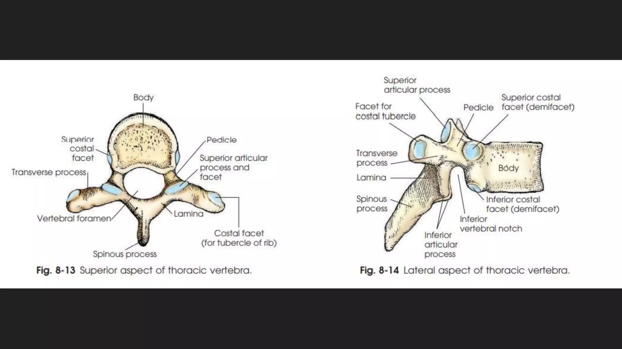 Radiographic anatomy of vertebral column | PPTX