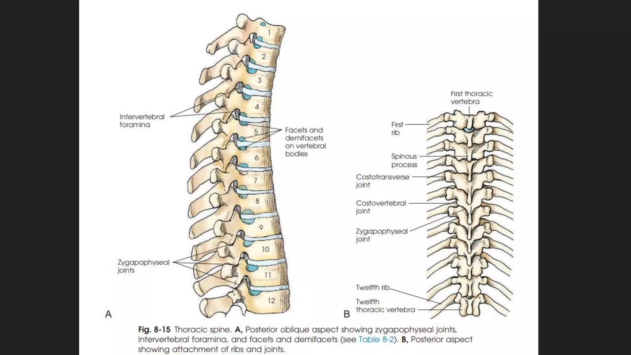 Radiographic anatomy of vertebral column | PPTX