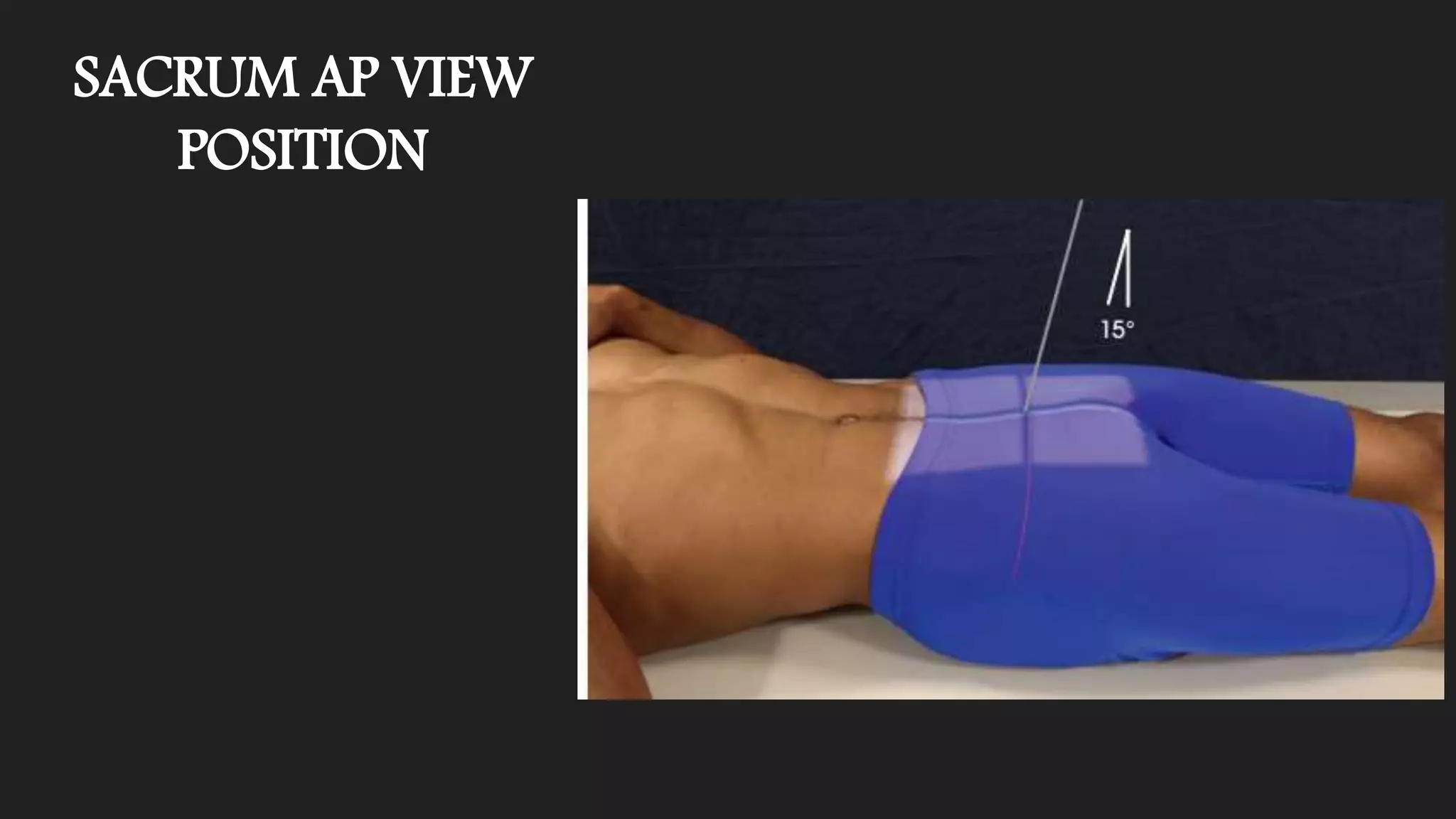 Radiographic anatomy of vertebral column | PPTX