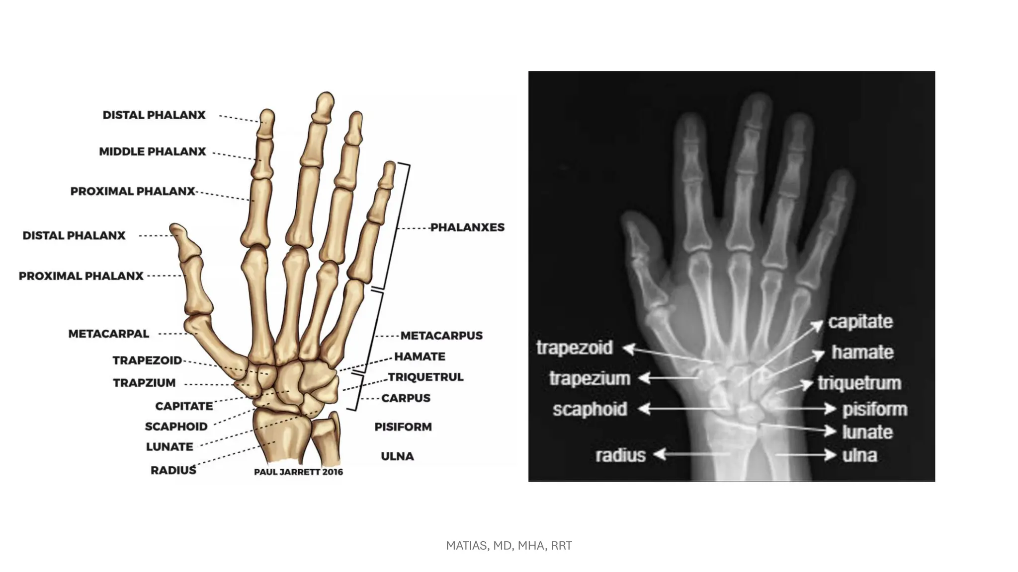 RADIOGRAPHIC ANATOMY RADIOGRAPHIC ANATOMY | PDF