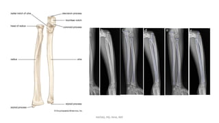 RADIOGRAPHIC ANATOMY RADIOGRAPHIC ANATOMY | PDF
