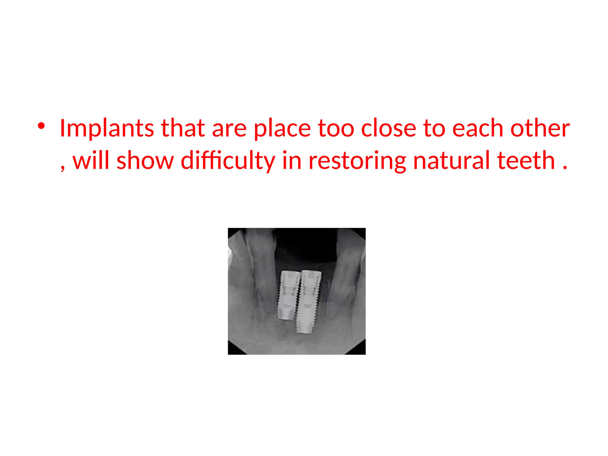 radiographic appearance of dental implant complications.pptx