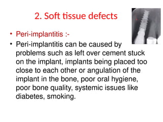 radiographic appearance of dental implant complications.pptx