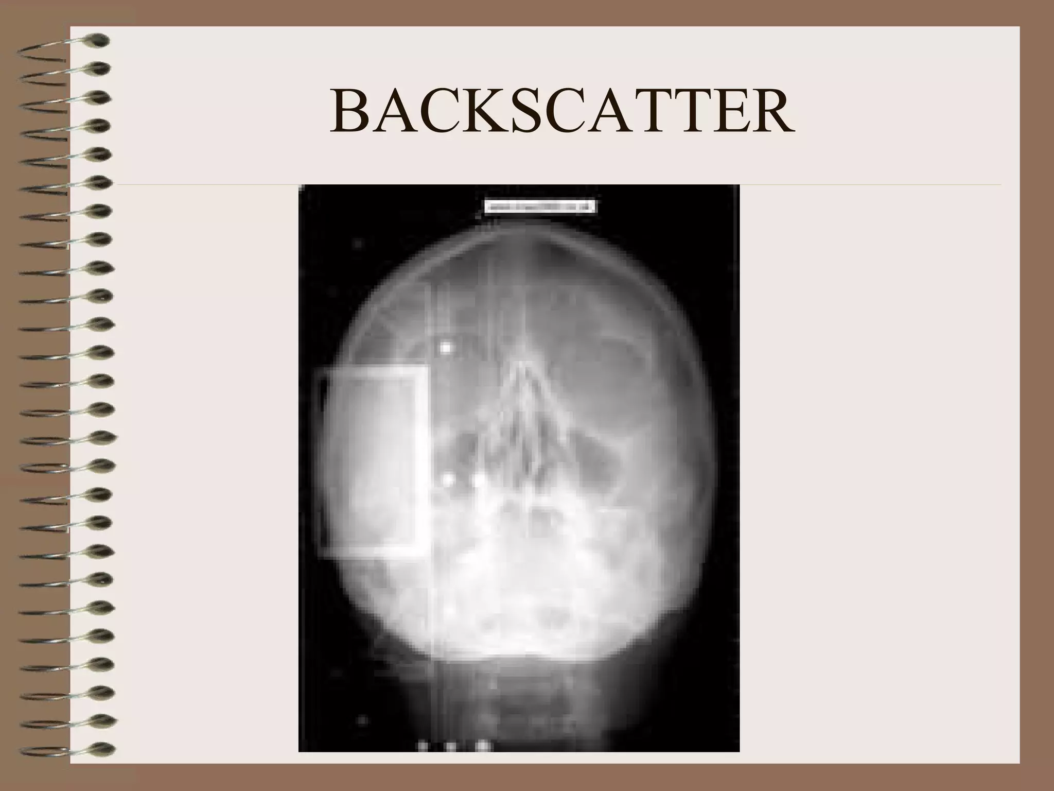 Radiographic artifacts | PPT