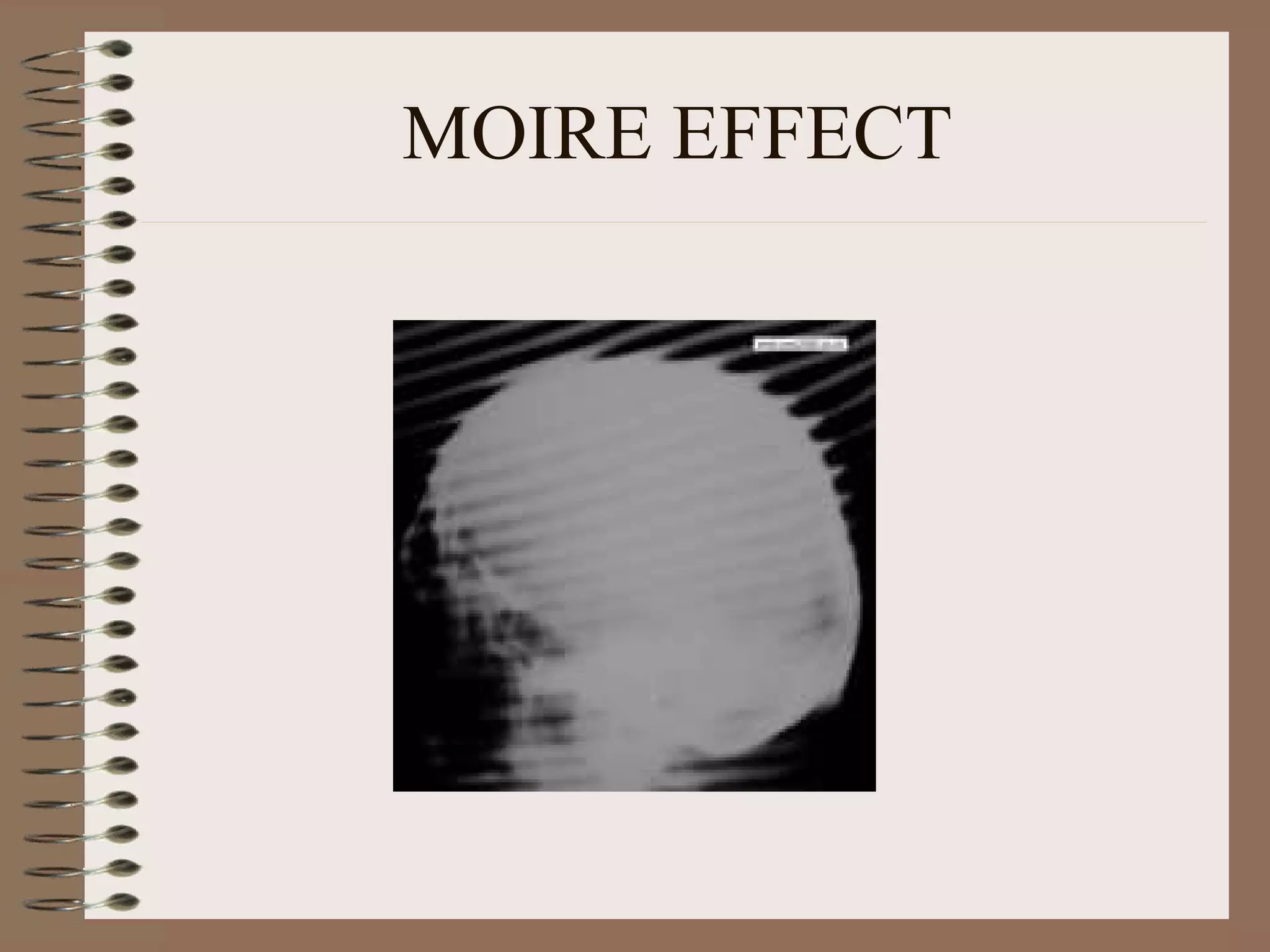 Radiographic artifacts | PPT