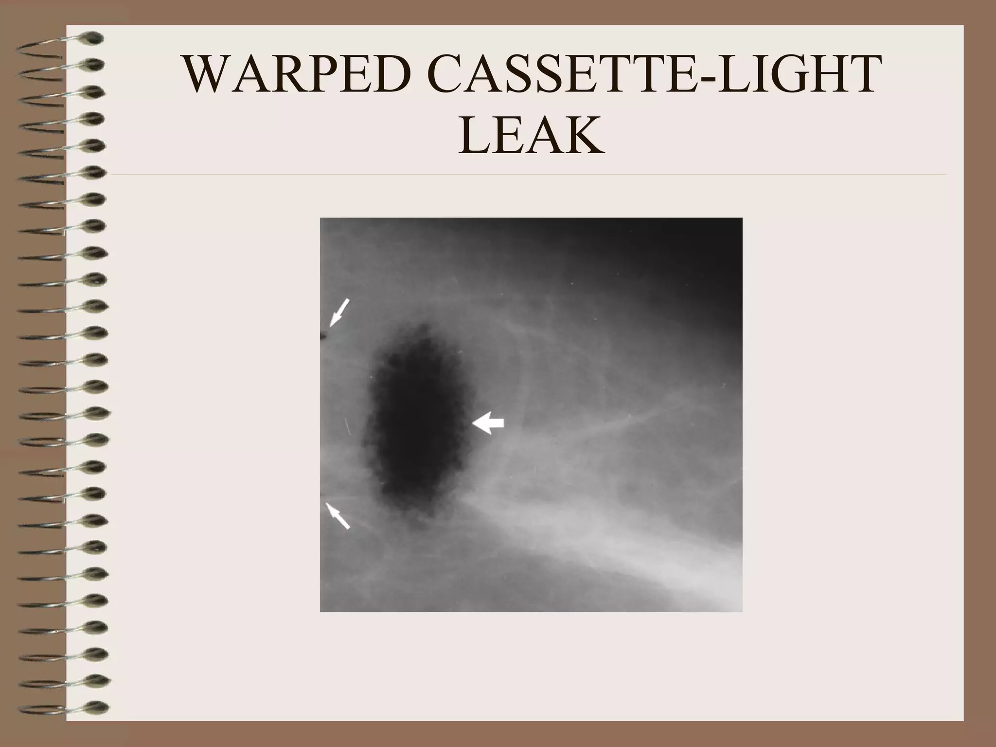 Radiographic artifacts | PPT