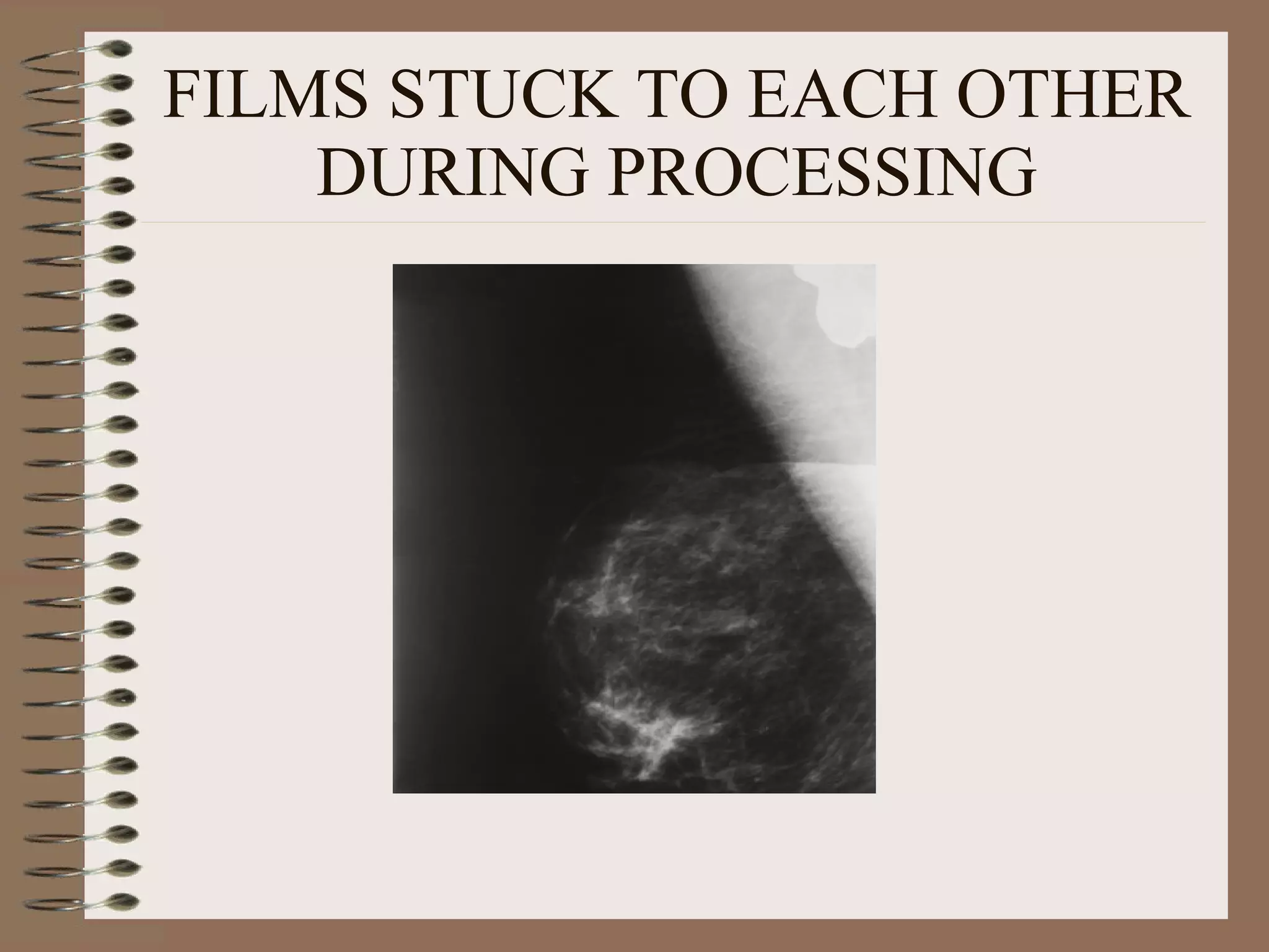 Radiographic artifacts | PPT