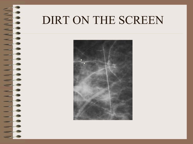 Radiographic artifacts | PPT | Science