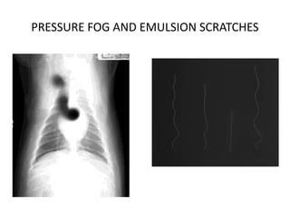 Radiographic Artifacts In Animals By Dr.Amandeep GADVASU | PPTX