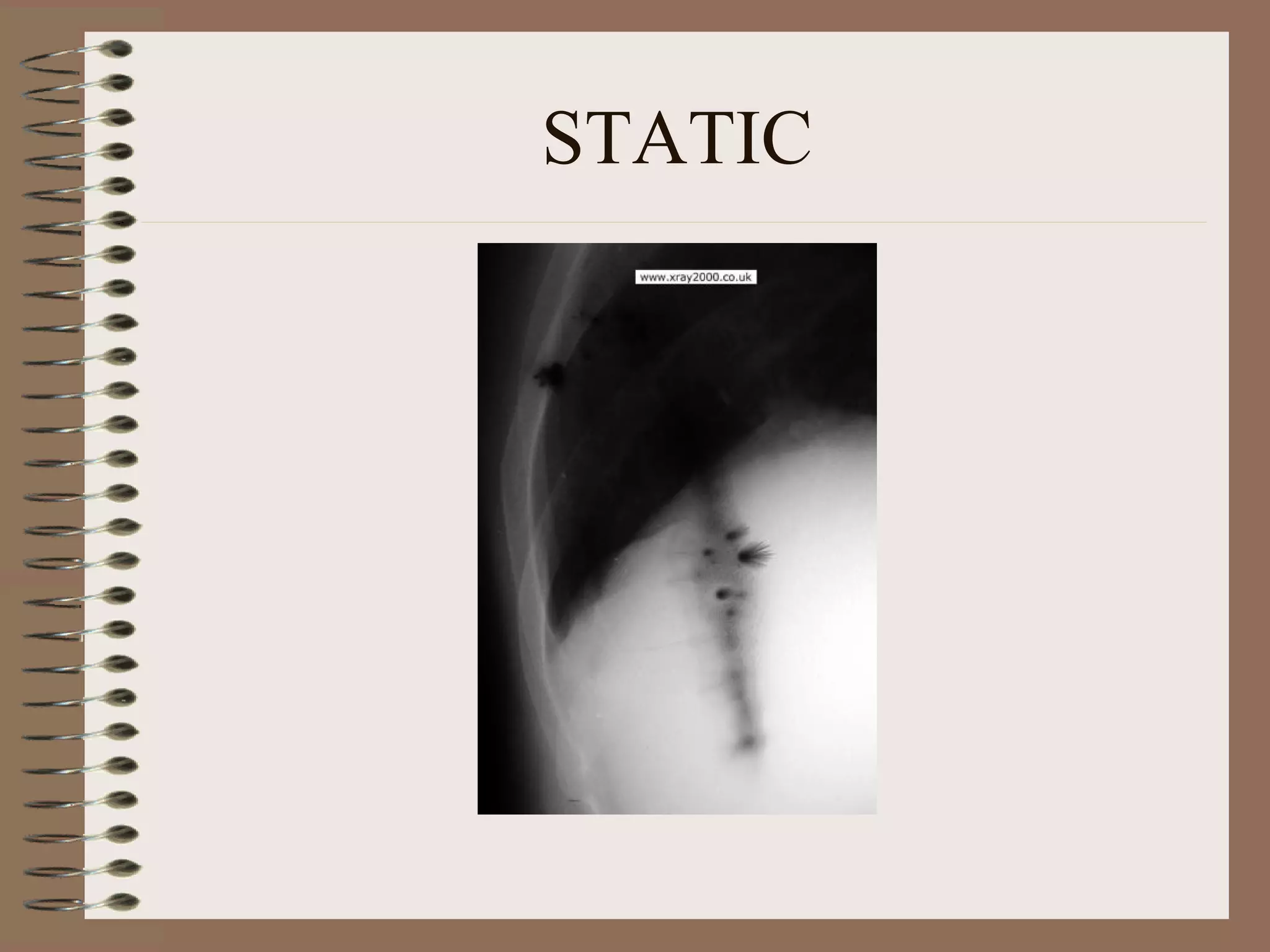 Radiographic artifacts 2 | PPT