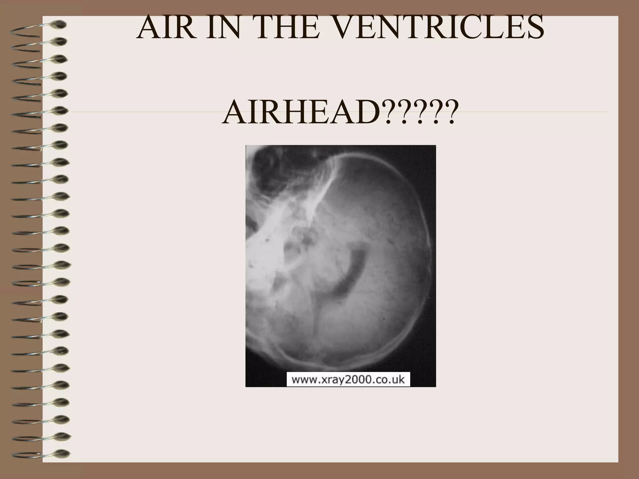 Radiographic artifacts 2 | PPT