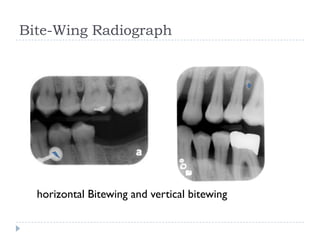 Radiographic assessment in paediatric dentistry | PPTX
