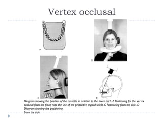 Radiographic assessment in paediatric dentistry | PPTX