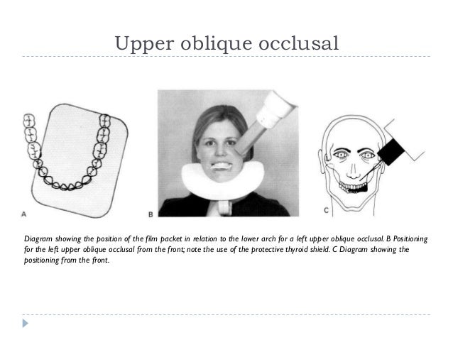 Radiographic assessment in paediatric dentistry
