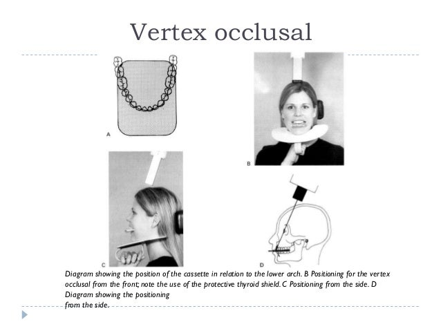 Radiographic assessment in paediatric dentistry