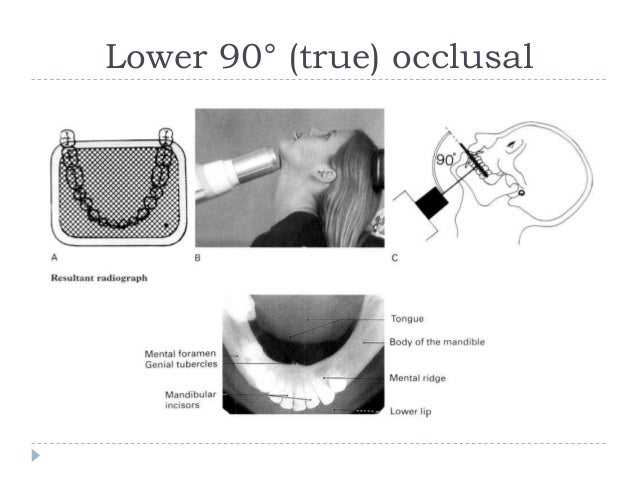 Radiographic assessment in paediatric dentistry