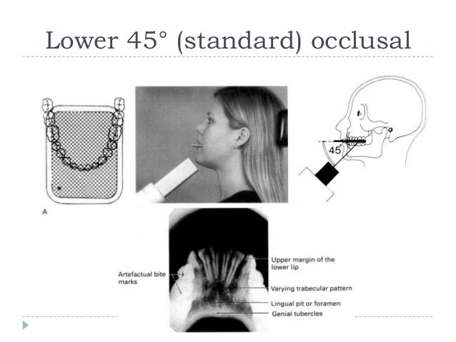 Radiographic assessment in paediatric dentistry