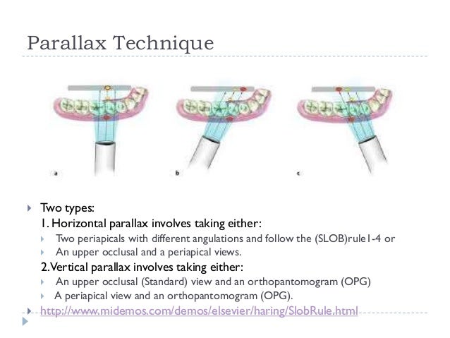 Radiographic assessment in paediatric dentistry