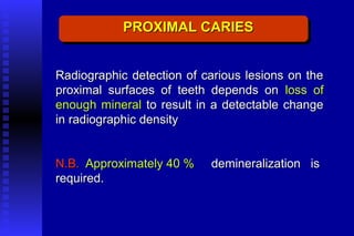 Radiographic assessment of dental caries | PPT