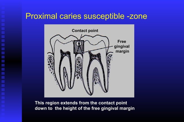 Radiographic assessment of dental caries | PPT