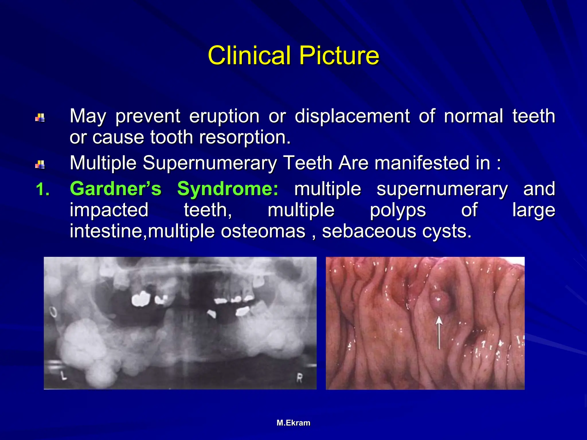 radiographicassessmentofdevelopmentalanomalies-190829211105.ppt