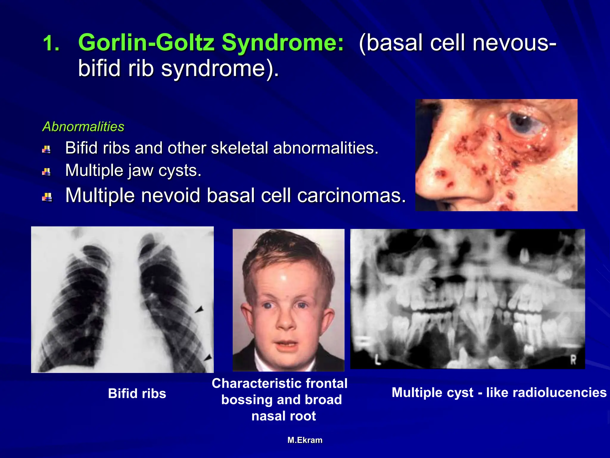 radiographicassessmentofdevelopmentalanomalies-190829211105.ppt