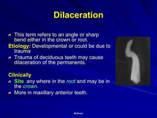 radiographicassessmentofdevelopmentalanomalies-190829211105.ppt