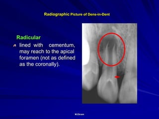 radiographicassessmentofdevelopmentalanomalies-190829211105.ppt