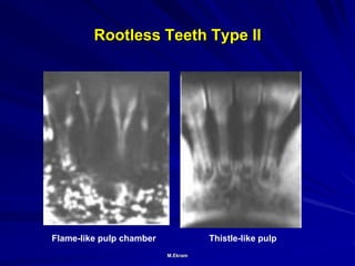 radiographicassessmentofdevelopmentalanomalies-190829211105.ppt