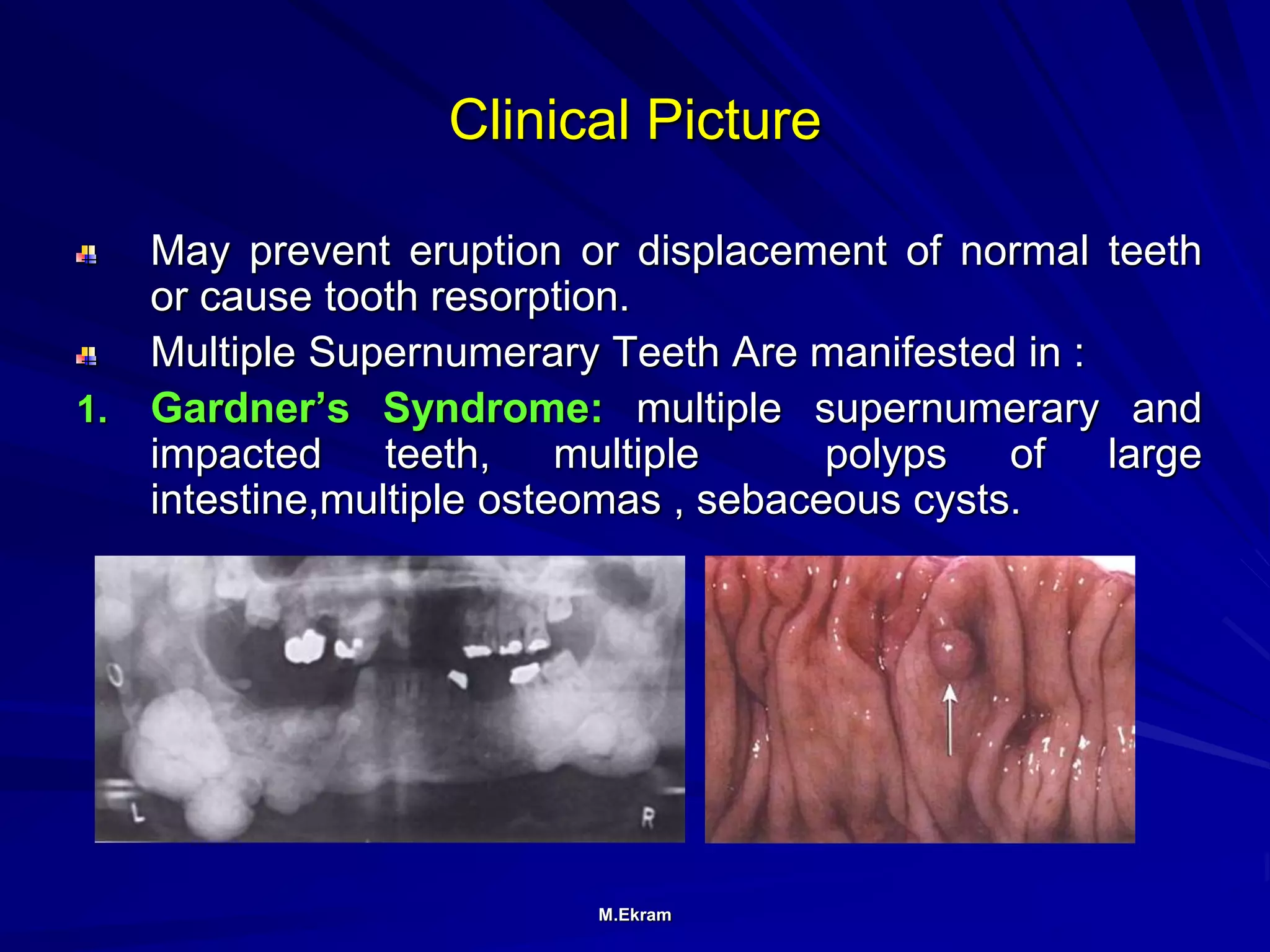 Radiographic assessment of teeth developmental anomalies | PPT