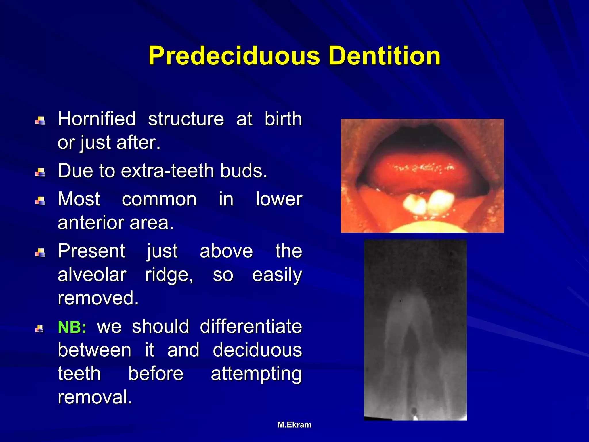 Radiographic assessment of teeth developmental anomalies | PPT