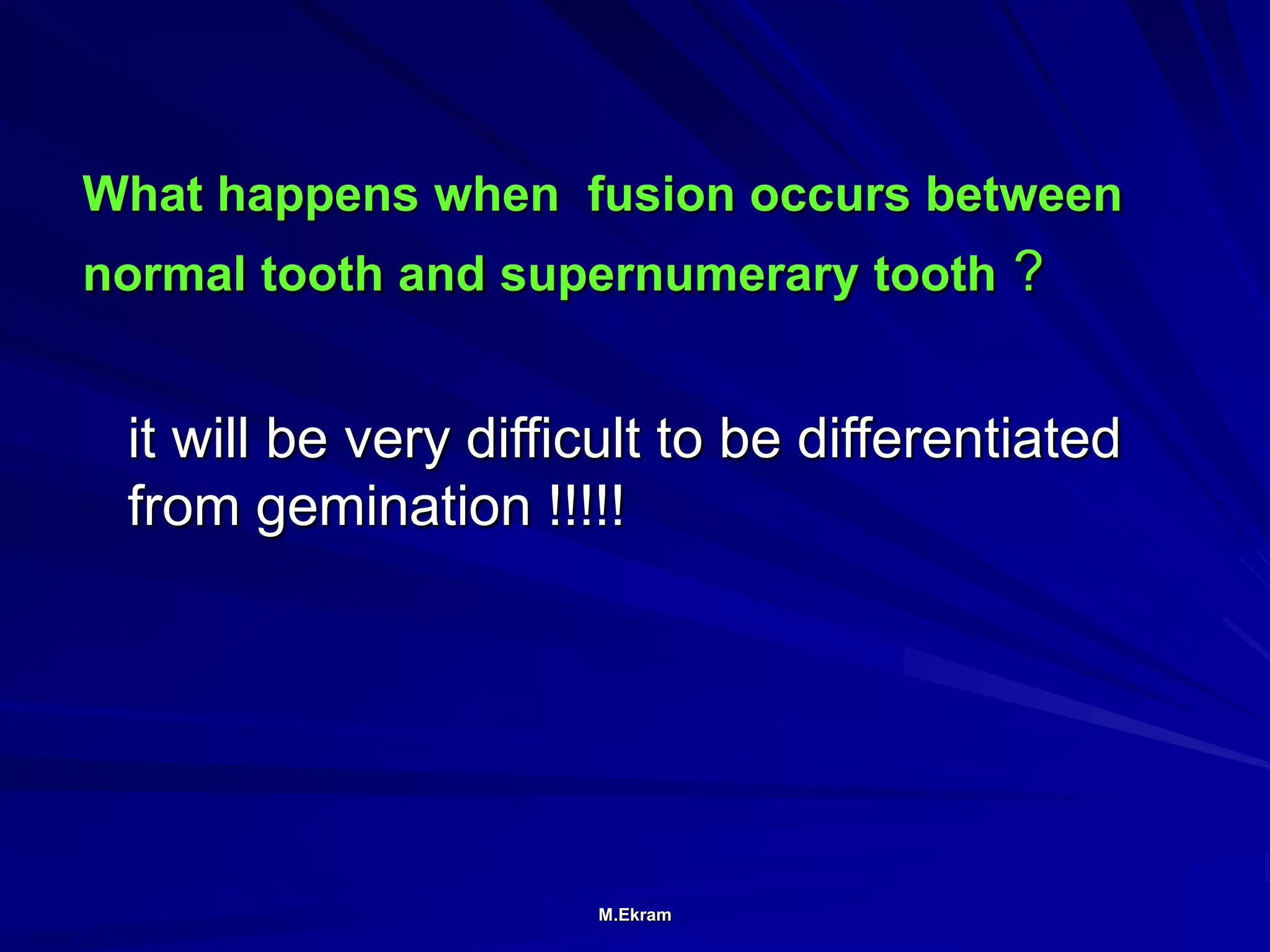 Radiographic assessment of teeth developmental anomalies | PPT