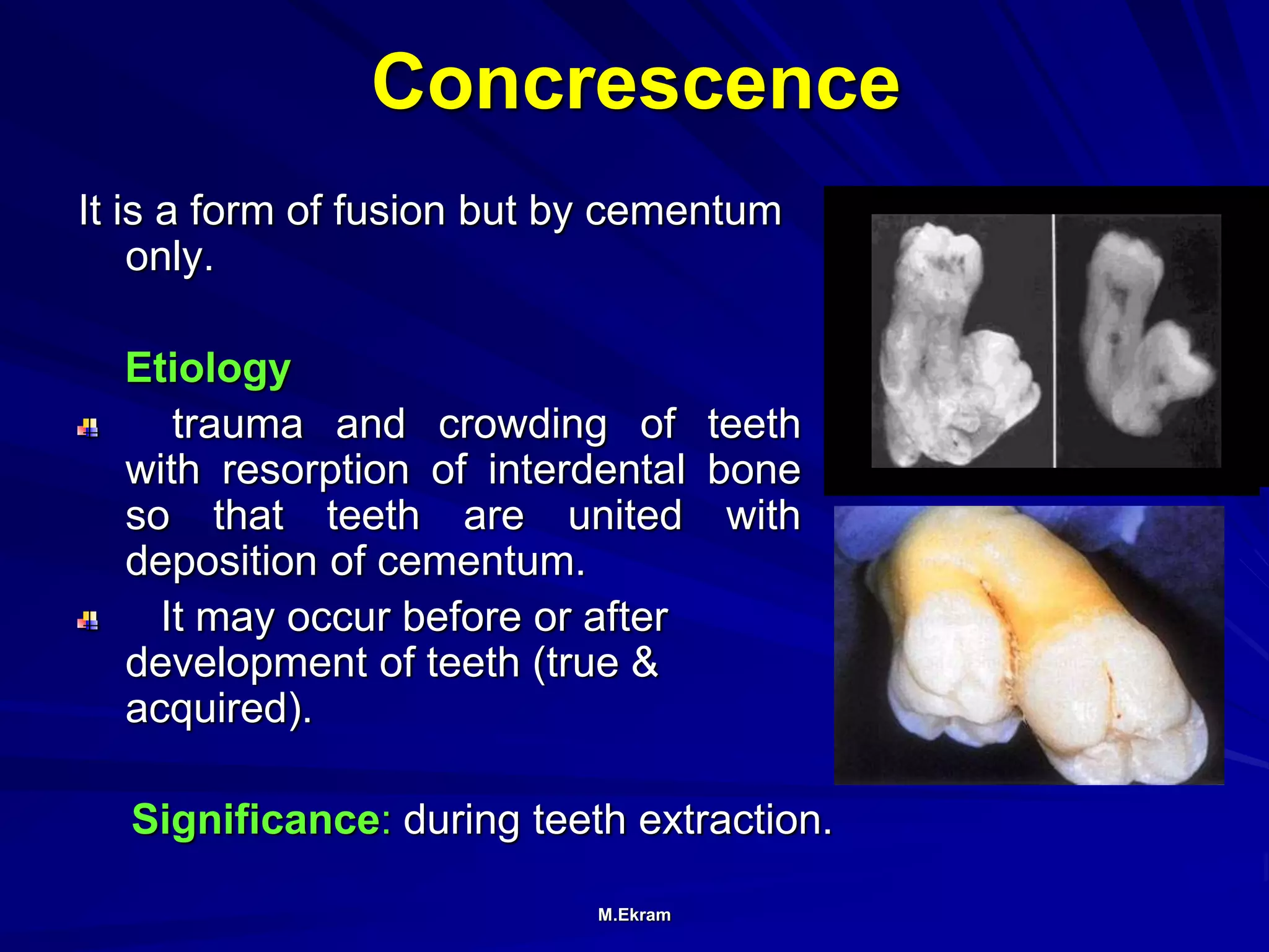 Radiographic assessment of teeth developmental anomalies | PPT