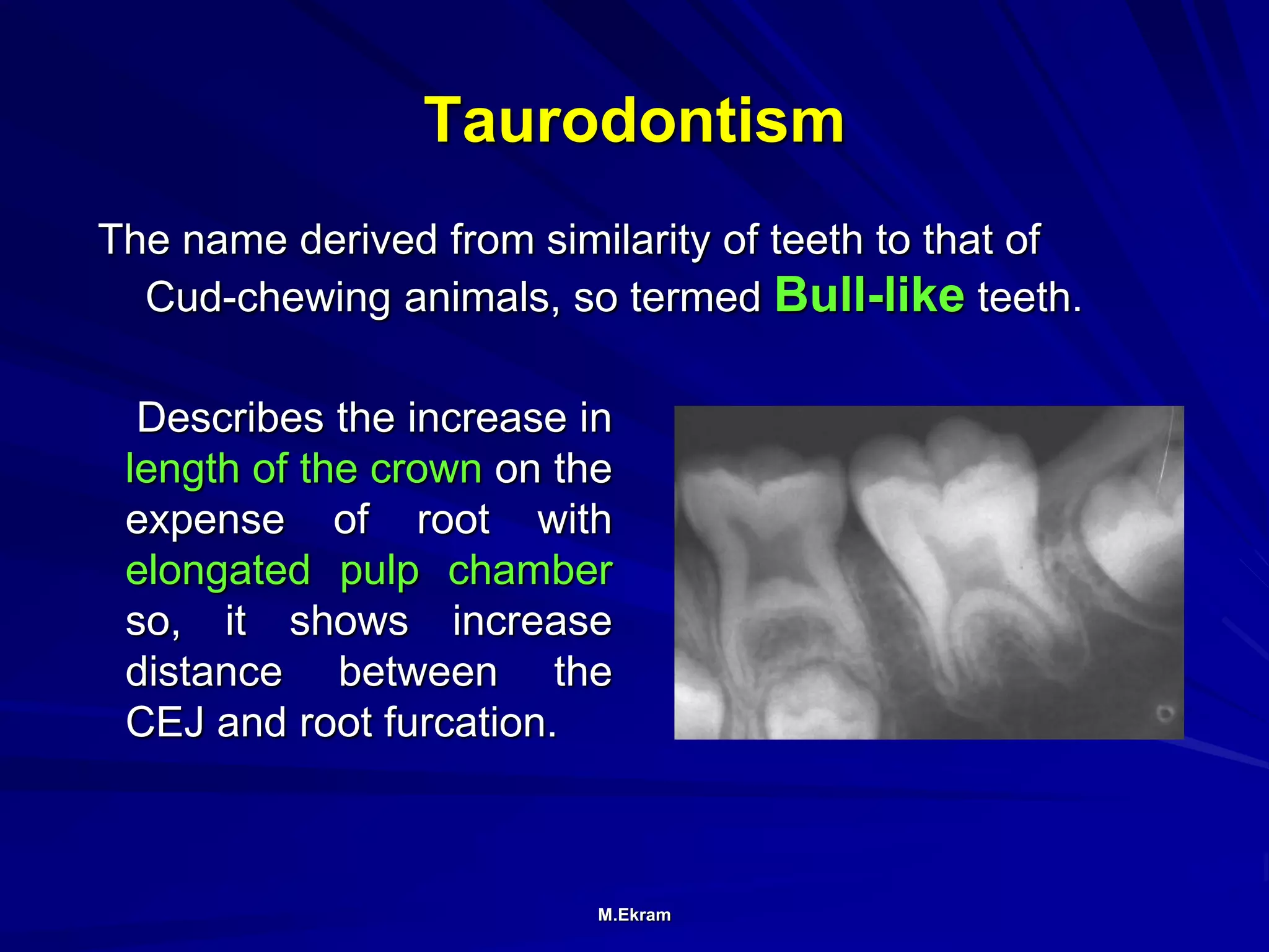 Radiographic assessment of teeth developmental anomalies | PPT