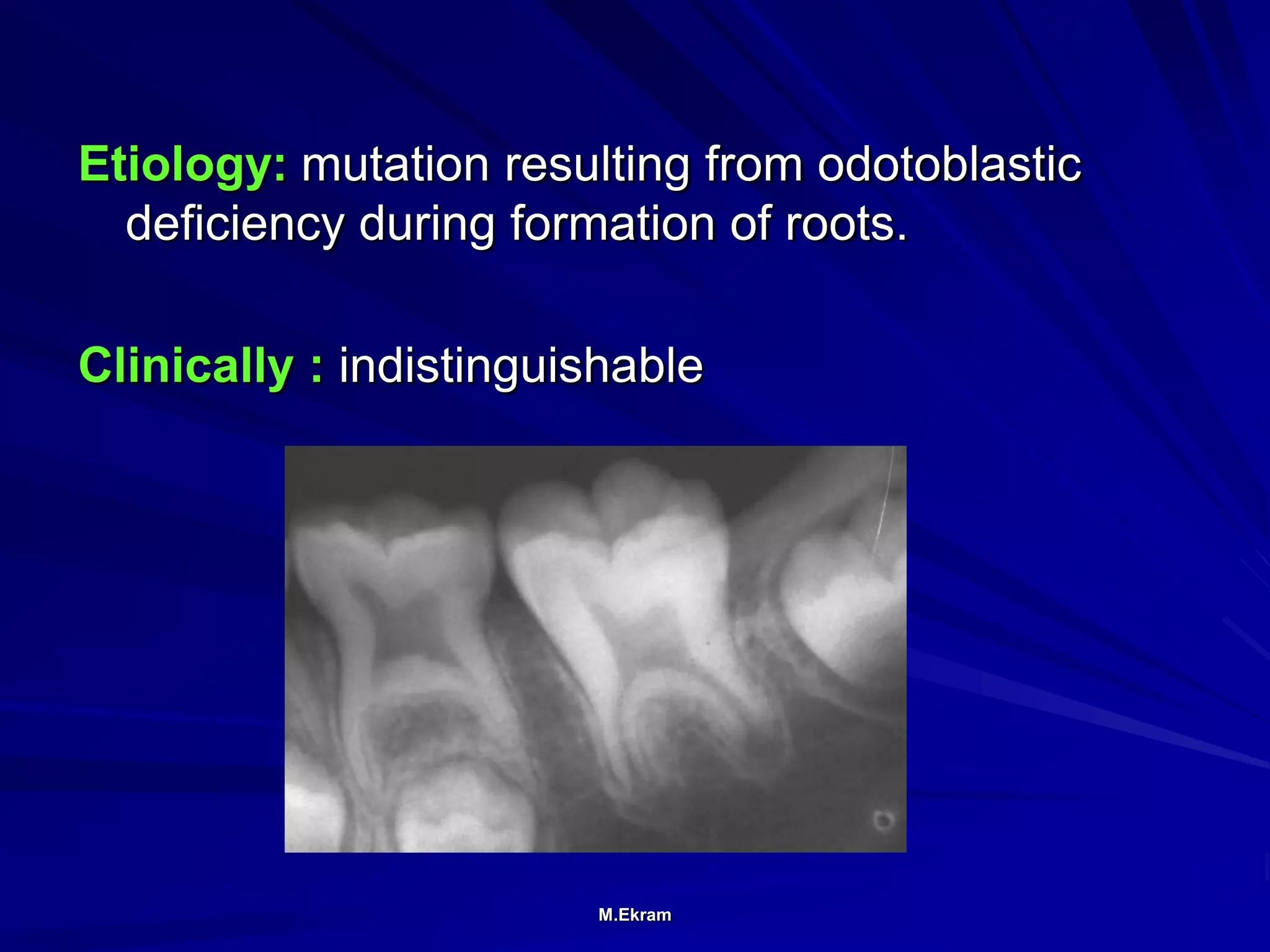 Radiographic assessment of teeth developmental anomalies | PPT