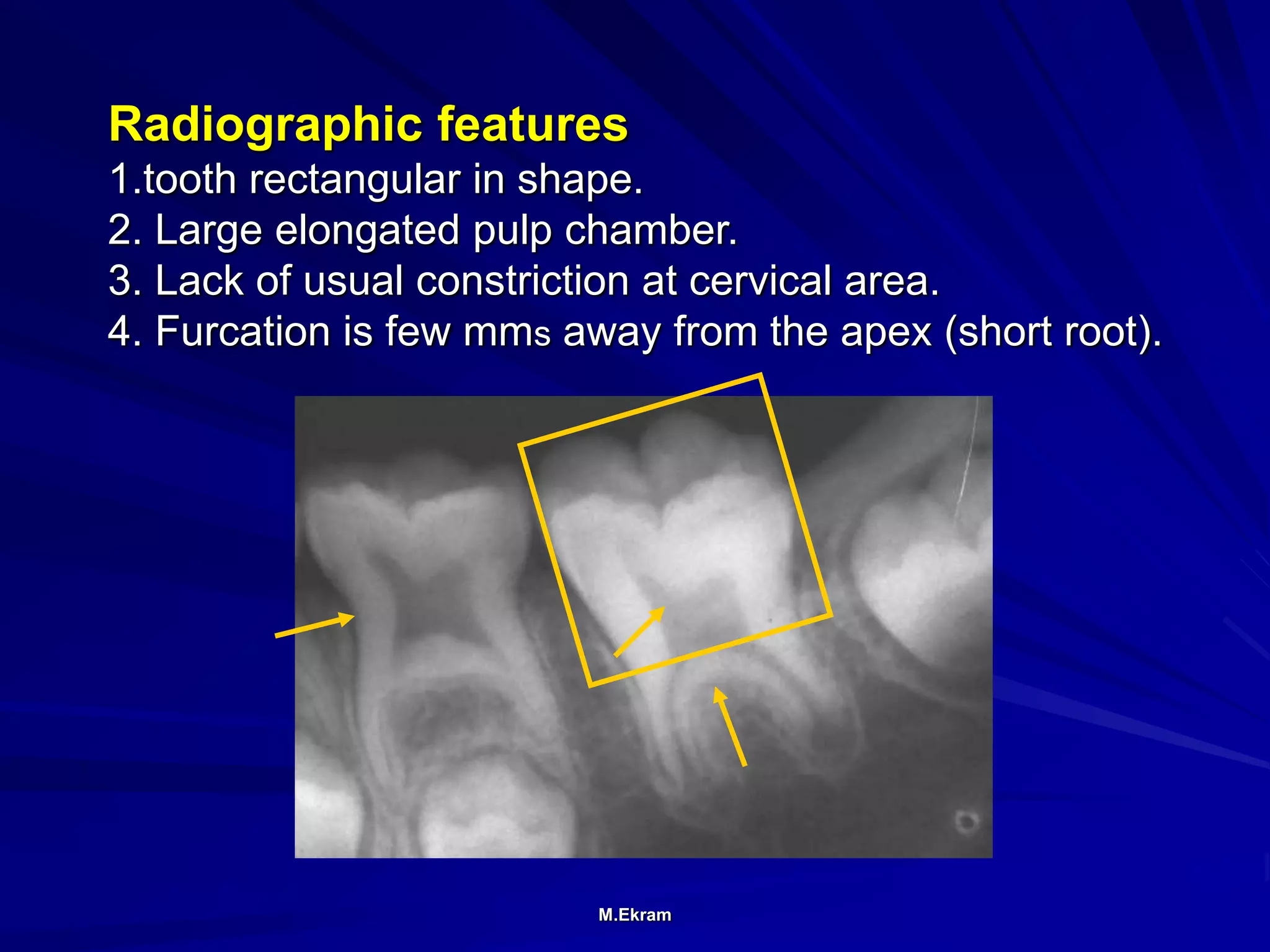 Radiographic assessment of teeth developmental anomalies | PPT