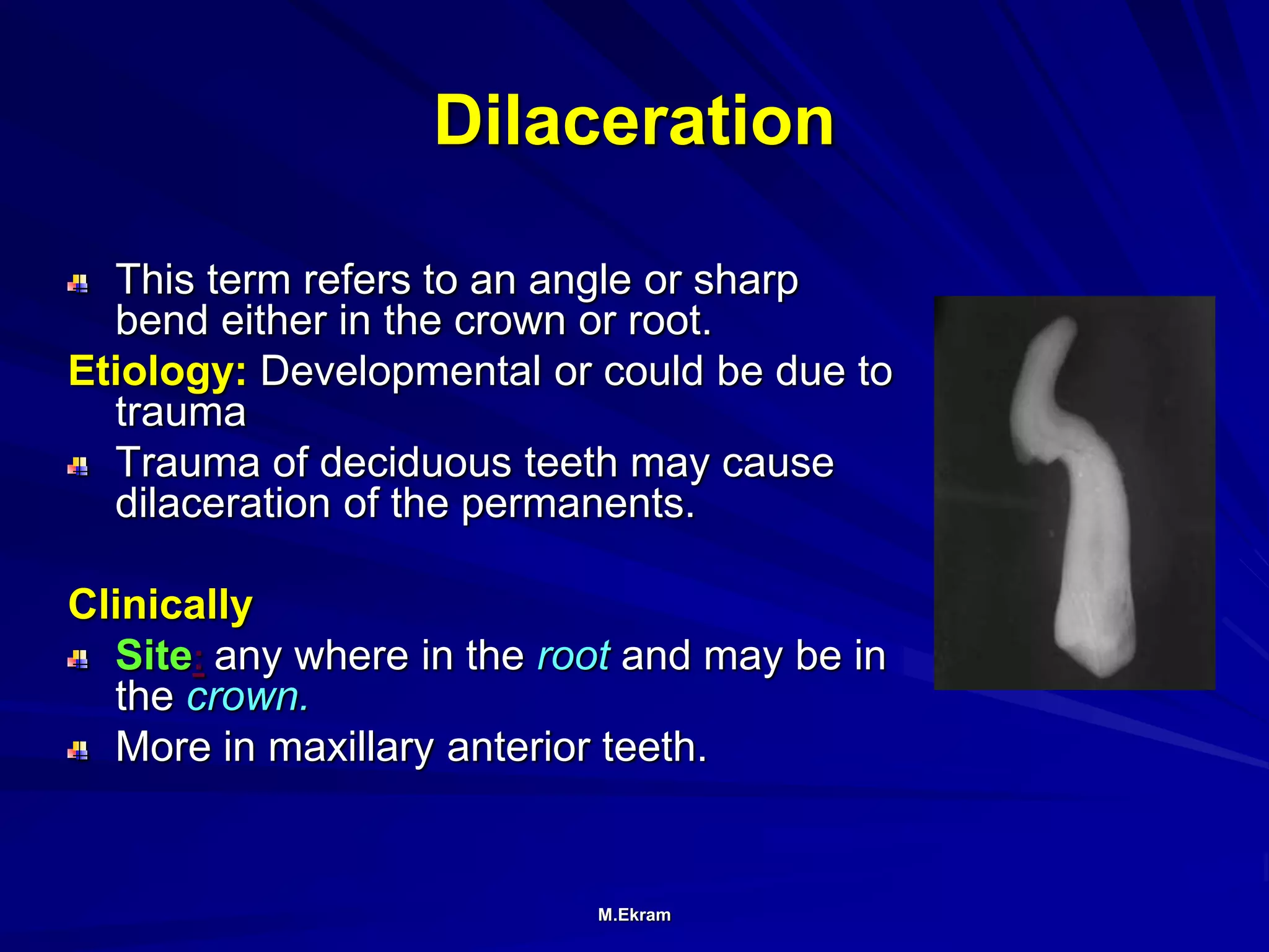 Radiographic assessment of teeth developmental anomalies | PPT