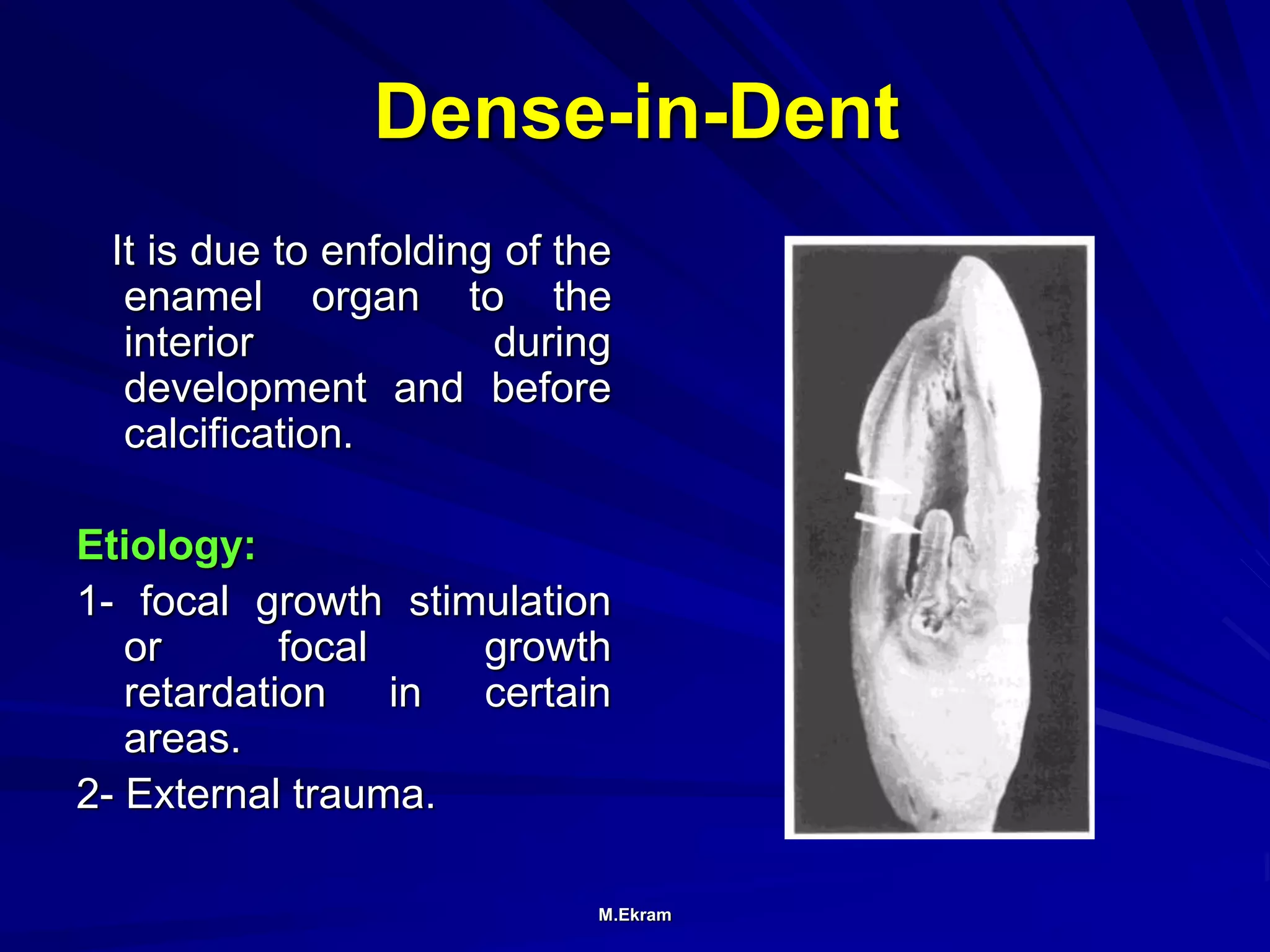 Radiographic assessment of teeth developmental anomalies | PPT