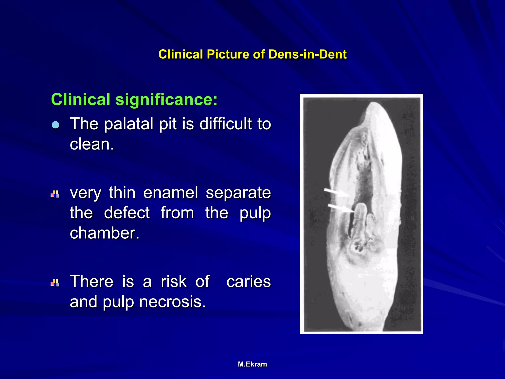 Radiographic assessment of teeth developmental anomalies | PPT