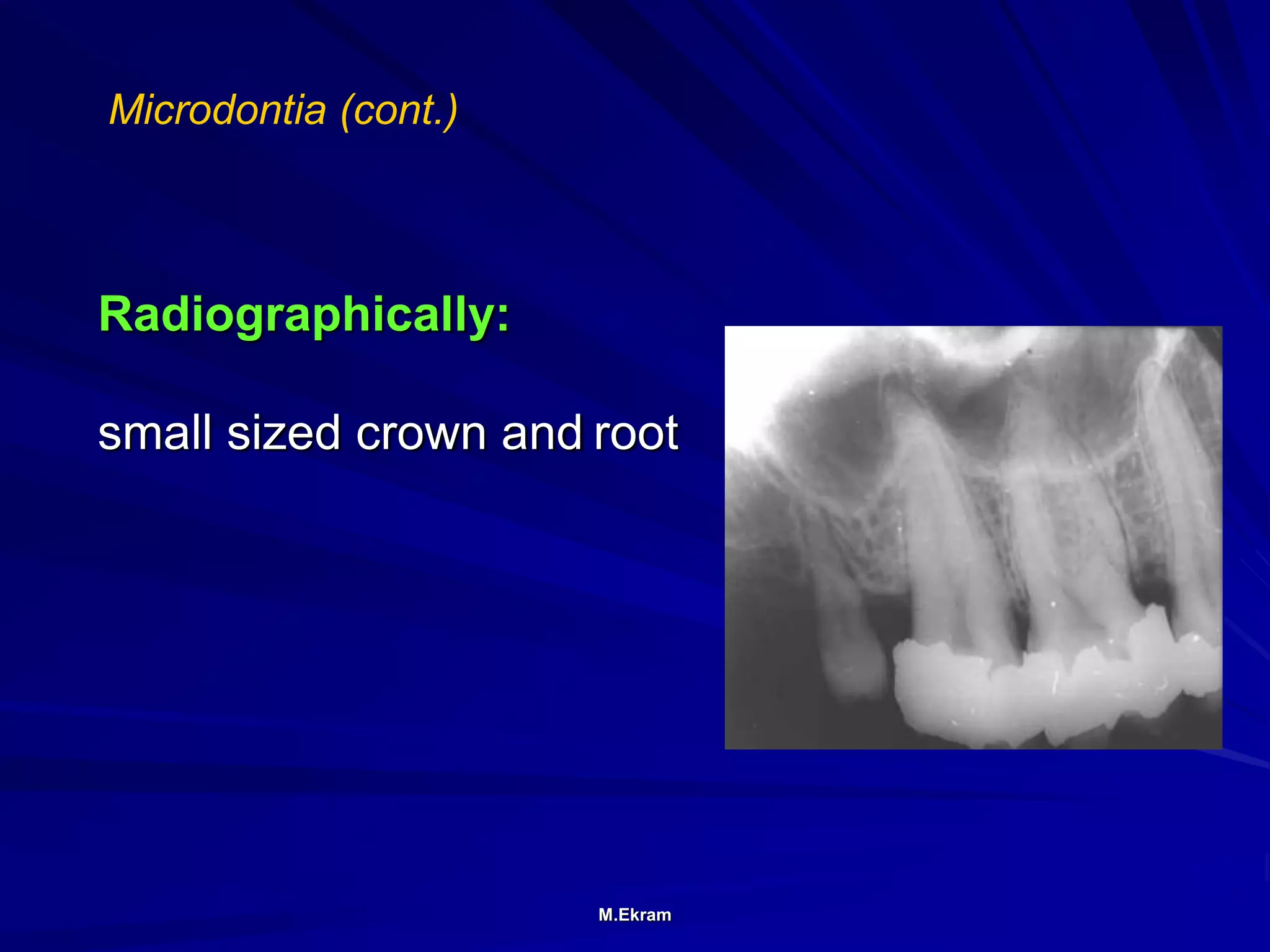 Radiographic assessment of teeth developmental anomalies | PPT