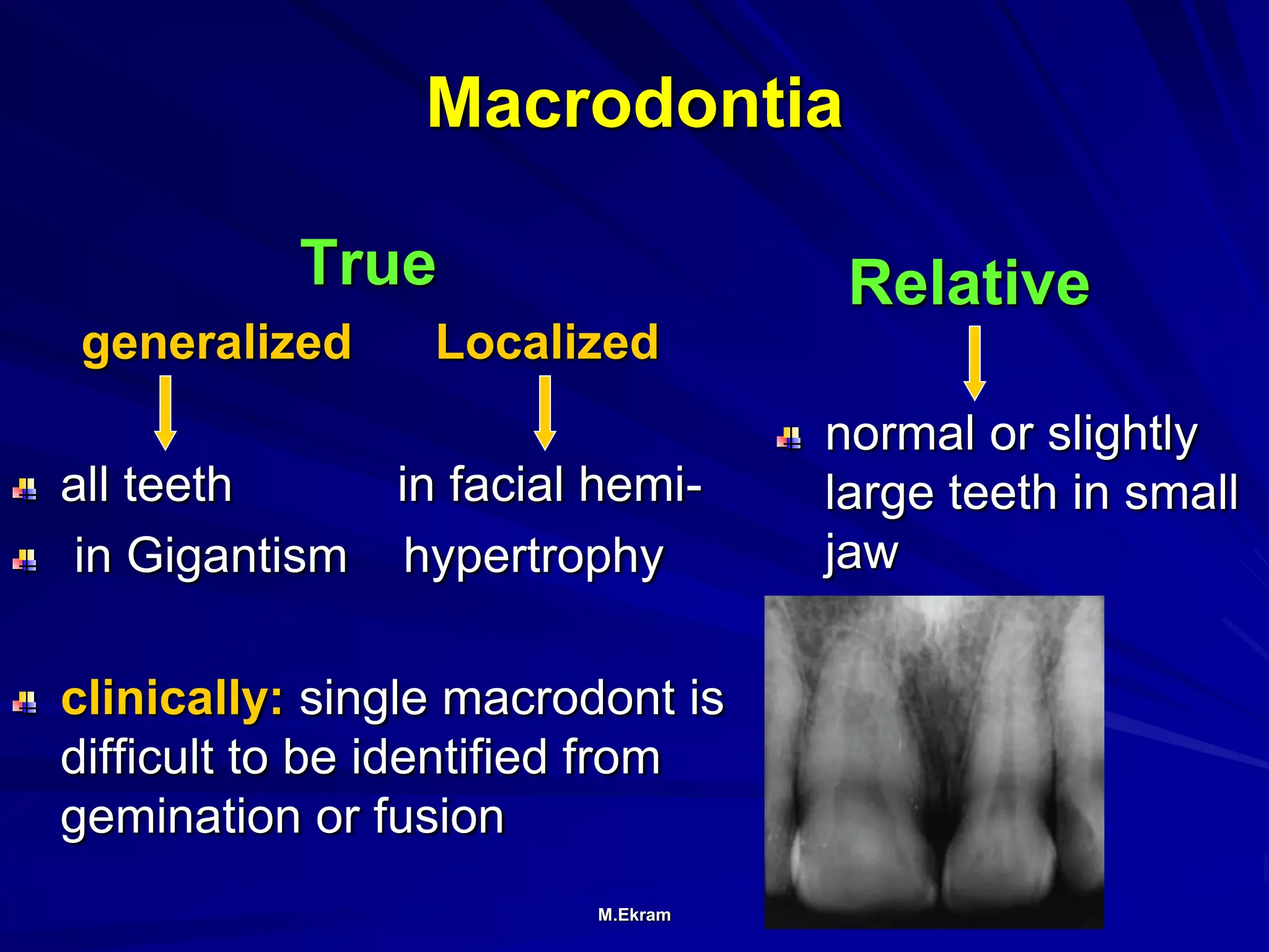 Radiographic assessment of teeth developmental anomalies | PPT