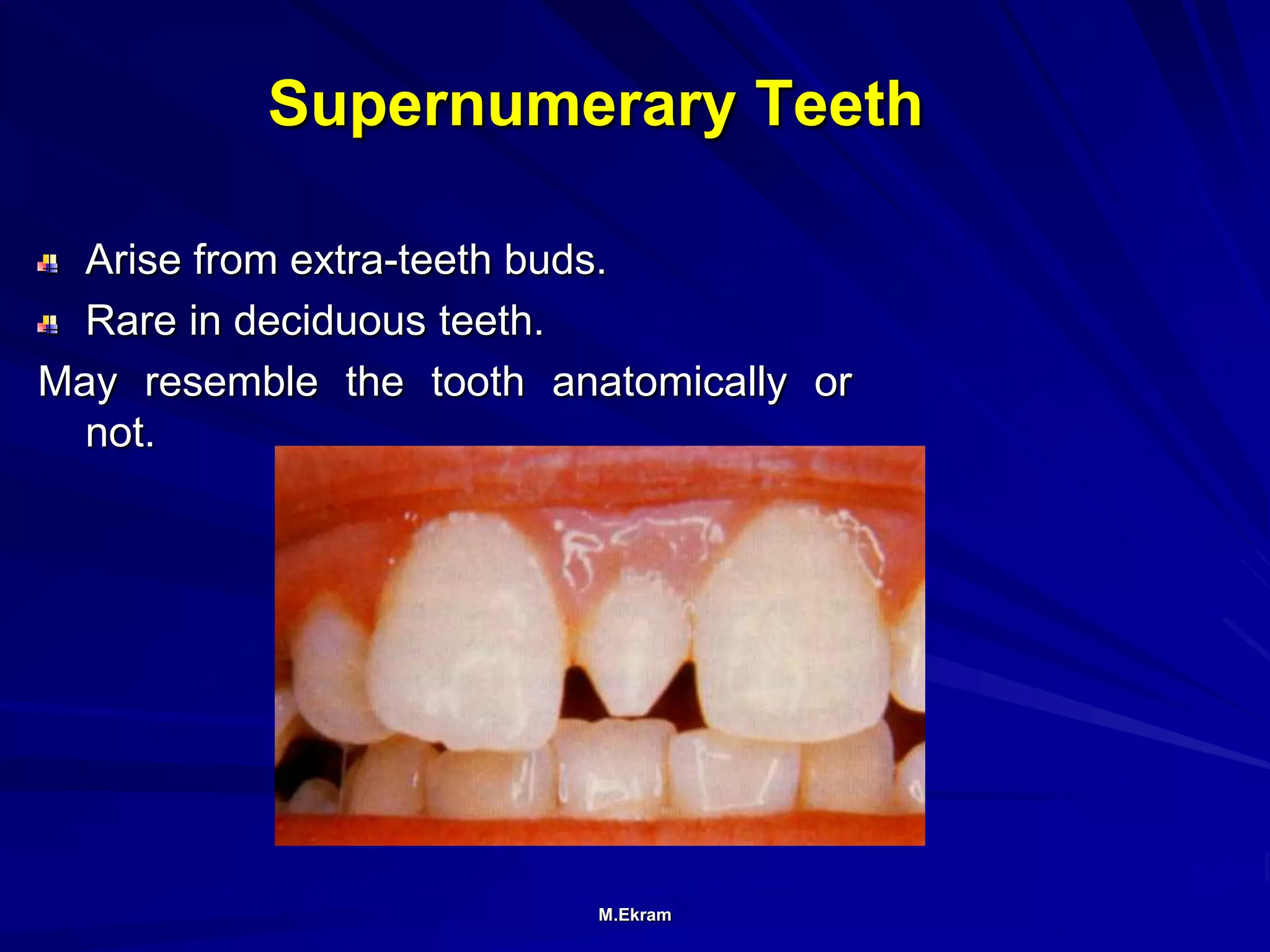 Radiographic assessment of teeth developmental anomalies | PPT